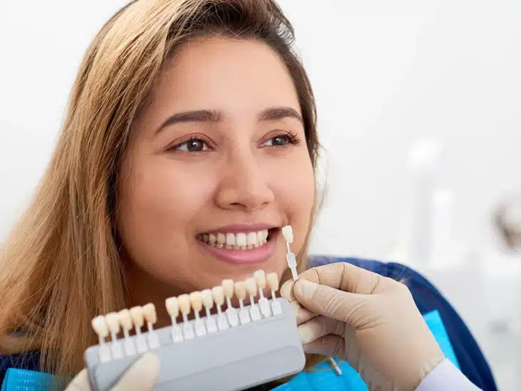 A Step-by-Step Look at the Dental Veneer Procedure