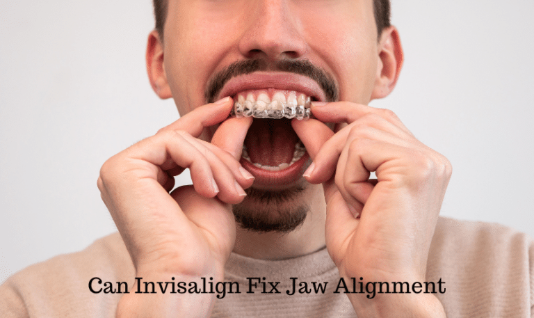 Can Invisalign Fix Jaw Alignment?